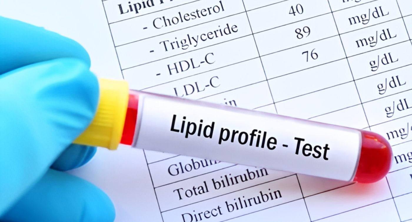 5 Crucial Tests Suggested By Doctors For Heart Diseases - Intima